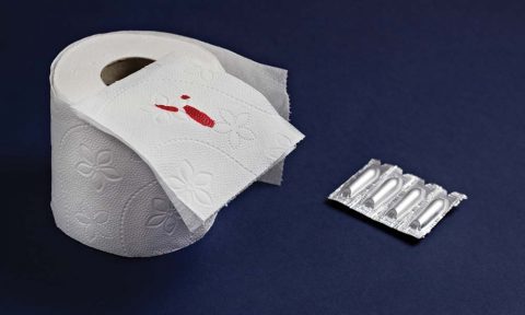 Rectal Bleeding Treatment, Causes, Symptoms & Remedies - Gastro Savannah